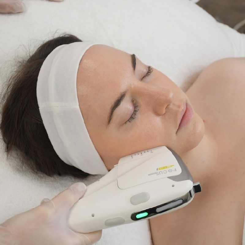 HIFU - High Intensity Focused Ultrasound by Sharp Fix Aesthetics in ...